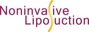 Logo LIPO – LipoDIET – Liposukcijska dijeta™